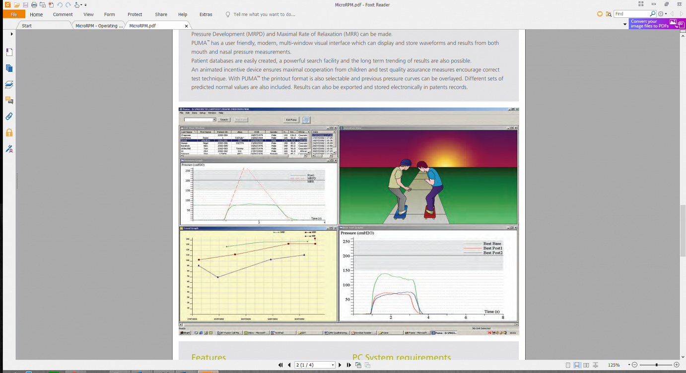 Συσκευή Μέτρησης Αναπνευστικών Μυών Micro RPM | Medical.gr
